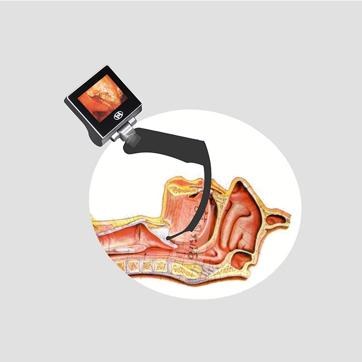 30 FPS Adult Video Assisted Laryngoscope 2 Million Pixels